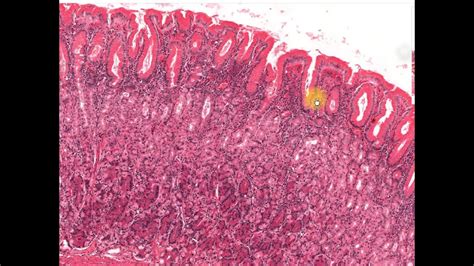 Histologia De Las Partes Del Estomago