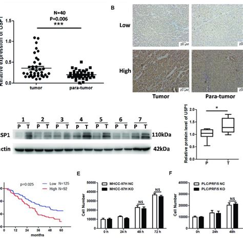 Elevated Expression Of USP1 In HCC A USP1 MRNA Levels In 40 Paired