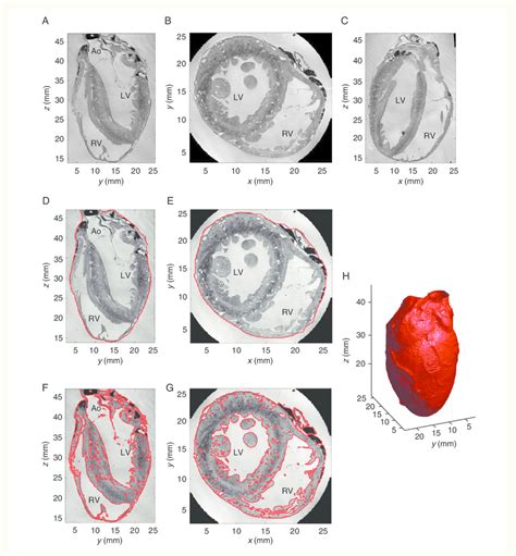 mri based tissue segmentation a c down sampled mri image in three download scientific