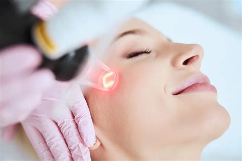 Effacer les cicatrices dacné au laser Jade Mazere