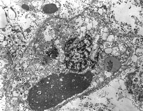 Public Domain Picture A Transmission Electron Micrograph Of The Ebola
