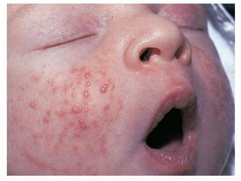 Pele do recém nascido o que você precisa saber Pediatria Descomplicada