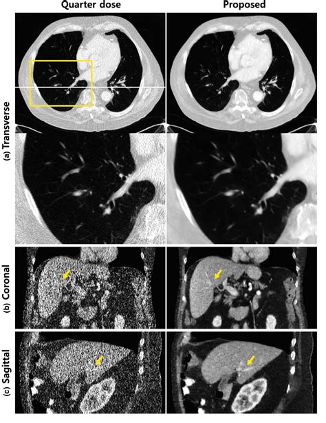 a deep convolutional neural network using directional wavelets for low dose x ray ct