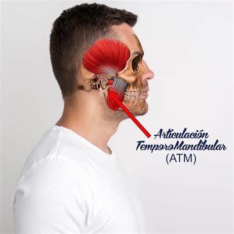 S Ndrome De Disfunci N T Mporo Mandibular Cleardent Cl Nicas Dentales