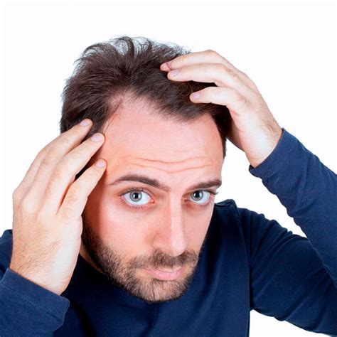 C Mo Hacer Crecer El Cabello M S R Pido En Hombres La Gu A De Las