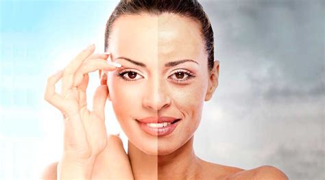 Peeling de Fenol Midas Medicina Estética no Centro RJ