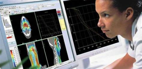 Radioterapia de Intensidade Modulada Saiba Mais Sobre a Técnica