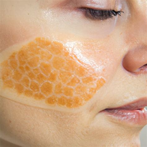 How Much Does A Chemical Peel Cost A Comprehensive Guide The