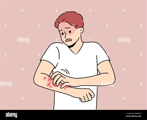 Homme Malsain Rayer Les Boutons Rouges Sur Le Bras Souffrent D Allergie