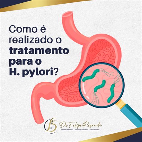 Dr Felipe Rezende Blog Como é realizado o tratamento para o H Pylori