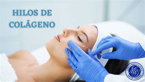 Beneficios De Los Hilos De Col Geno Mayte Garrido