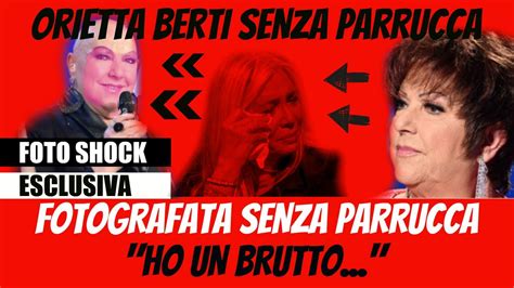 FOTO SHOCK DI ORIETTA BERTI SENZA PARRUCCA Ho Un Oriettaberti