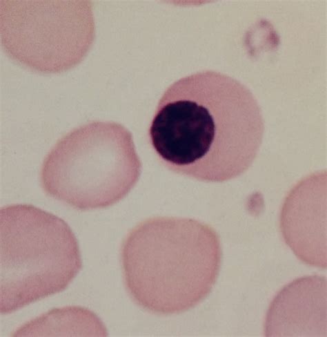 Hematology Lab Flashcards Quizlet