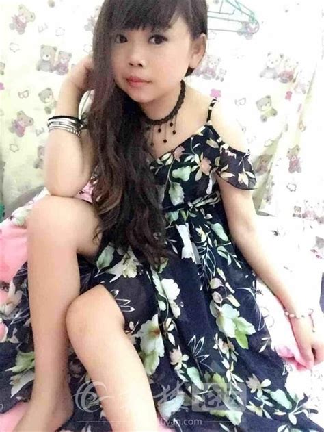 늙지 않는 병 하이랜더 증후군 의 진실 미스터리 공포 에펨코리아