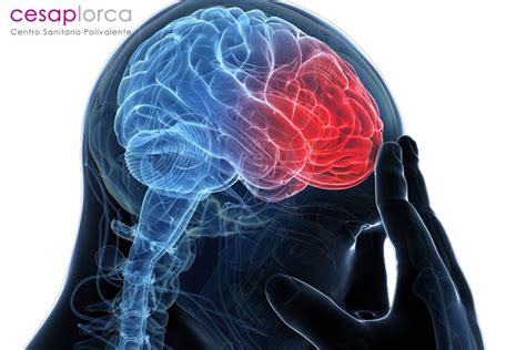 Traumatismo craneoencefálico Causas y Tratamiento CESAPLORCA