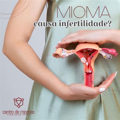 Mioma Causa Infertilidade