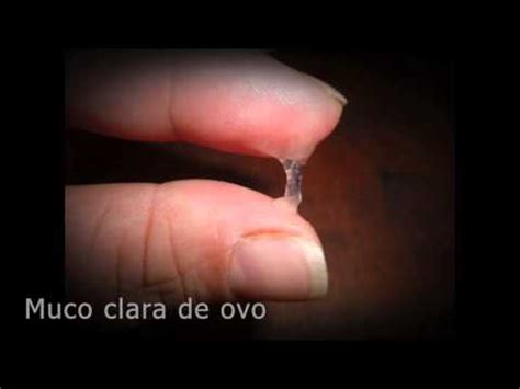 Aprender sobre 96 imagem muco cervical antes da menstruação fotos br