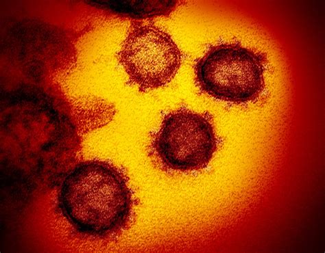 Tutte Le Facce Del Nuovo Coronavirus In Nuove Immagini Al Microscopio