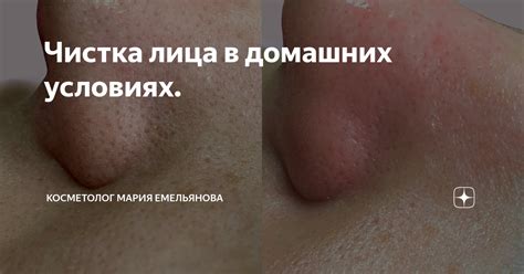 Чистка лица в домашних условиях Косметолог Мария Емельянова Дзен