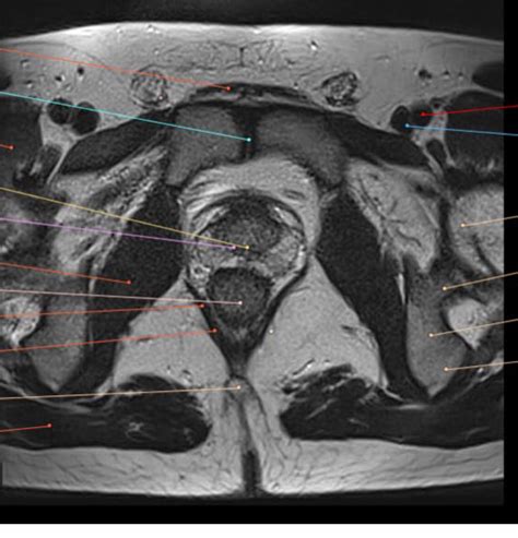 Males Mri Axial Pelvis 11 Diagram Quizlet