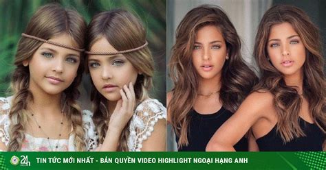 Cặp song sinh đẹp nhất thế giới có đôi mắt hút hồn triệu người 13 năm