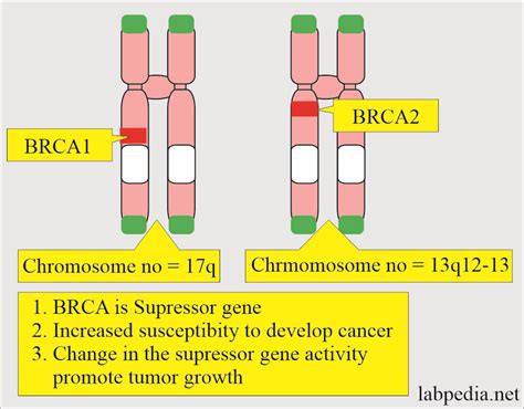 Tumor Marker Part 6 BRCA1 BRCA2 Significance In Breast Cancer