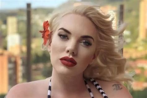 La Modelo Jennifer Barlow Anuncia Que Le Han Amputado Una Pierna Por