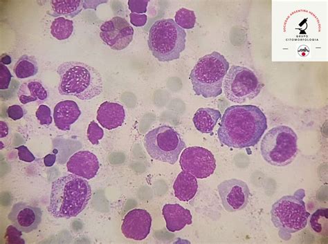 Sociedad Argentina De Hematolog A
