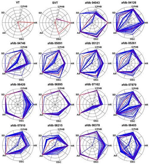 sensors free full text an adaptive median filter based on sampling rate for r peak detection