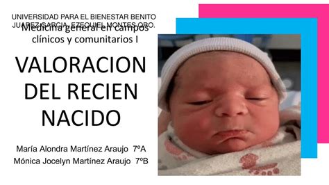Valoración del Recién Nacido Monica Jocelyn Martinez Araujo uDocz