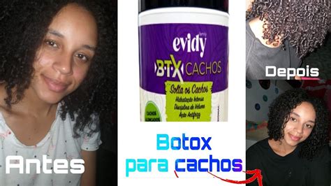 USEI O BOTOX PARA CACHOS DA EVIDY PELA PRIMEIRA VEZ SERÁ QUE FUNCIONOU