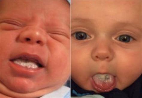 C Mo Limpiar La Lengua De Mi Beb Vidaprenatalcenter