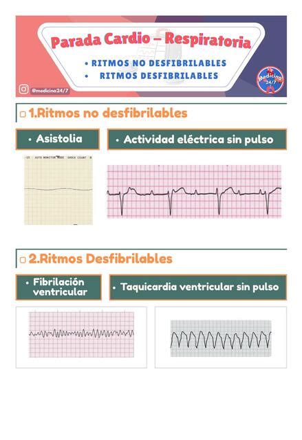 Causas Reversibles De Parada Cardiorrespiratoria Ritmos