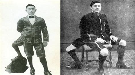 La increíble vida del hombre que nació con 3 piernas y el secreto de su