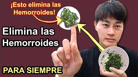Elimina Las Hemorroides PARA SIEMPRE Esto Cura Hemorroides De