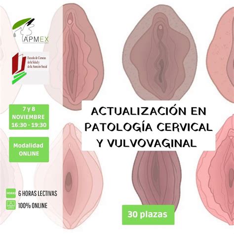 Asociación Matronas Extremadura CURSO ACTUALIZACION EN PATOLOGÍA