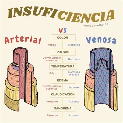 Historia Natural De La Enfermedad Insuficiencia Arterial Y Venosa
