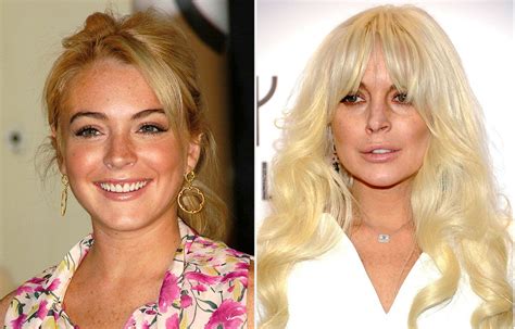Molesto Revelar capítulo famosos antes y despues de las cirugias bien