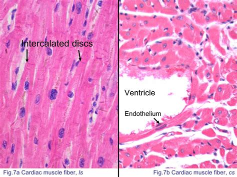 Cardiac Muscle Cross Section
