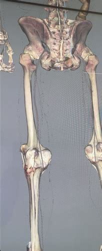 Lower Extremity Lab Nerves Flashcards Quizlet