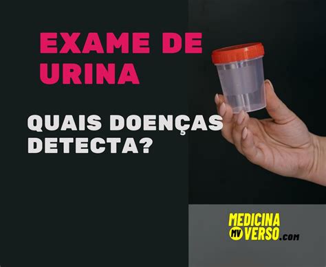 Exame De Urina Detecta Quais Doen As Entenda Esse Exame Medicina Verso