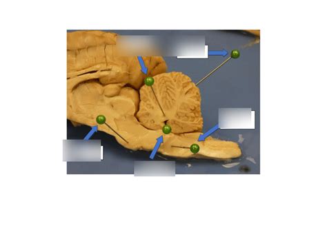 Sheep Brain Dissection 4 Diagram Quizlet