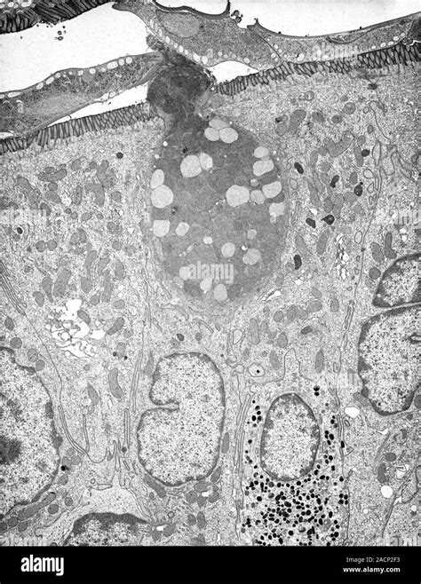 Des cellules caliciformes Micrographie électronique à transmission