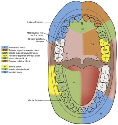 Types Of Dental Nerve Blocks