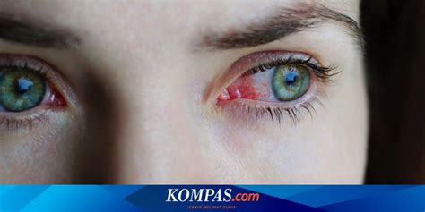 2 Penyebab Mata Kering Dan Perih Yang Perlu Diketahui