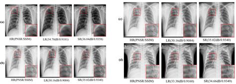 sensors free full text fast image super resolution using particle swarm optimization based