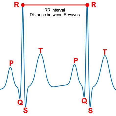 qrs complex of ecg signal download scientific diagram