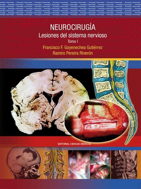 Neurocirug A Lesiones Del Sistema Nervioso Aliovys Caltona La Rosa
