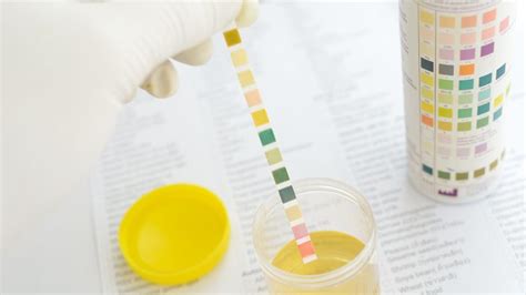 Białkomocz przyczyny objawy diagnostyka leczenie Poradnik Gemini