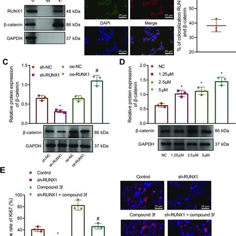 RUNX1 activates the Wnt β catenin signaling pathway to promote the
